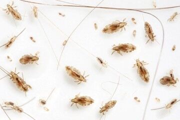 Hedrin Review: No-comb head lice treatment that kills eggs and nits