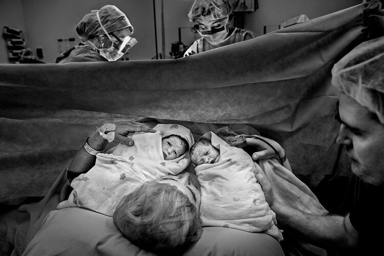 All Births Are Beautiful: Stunning Photos That Prove It