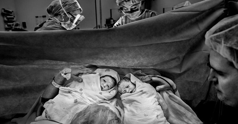 All Births Are Beautiful: Stunning Photos That Prove It