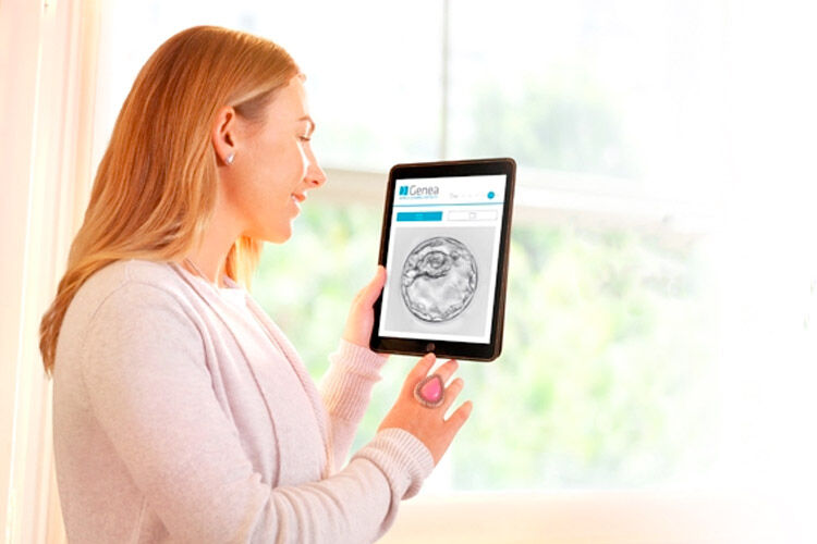 New app lets IVF patients watch their embryos grow in real-time