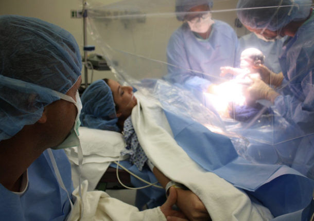 Clear drape c-sections allow mums to watch baby being born