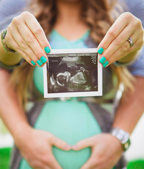 7 creative ways to display an ultrasound photo | Mum's Grapevine