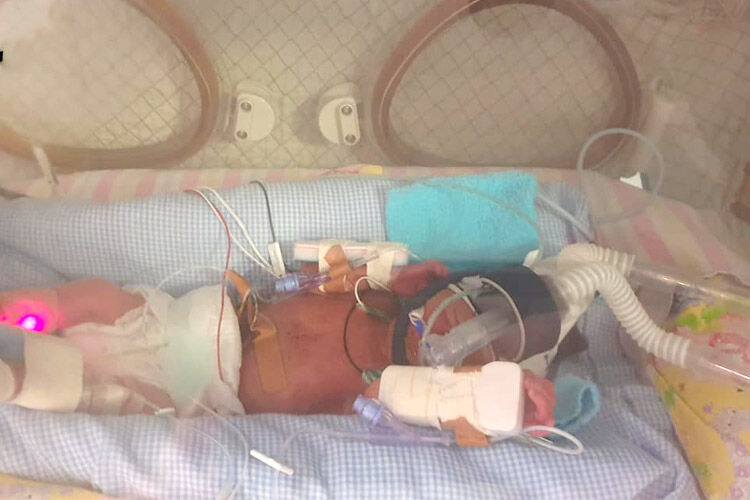 Birth Story: My Baby Was Born at 27 Weeks