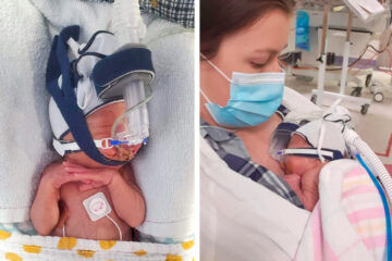 Birth Story: My Baby Was Born at 27 Weeks