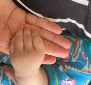 At two days old they amputated Laura's sons thumb